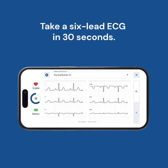 KardiaMobile 6-Lead Personal ECG Heart Rate Monitor Advanced Heart ...