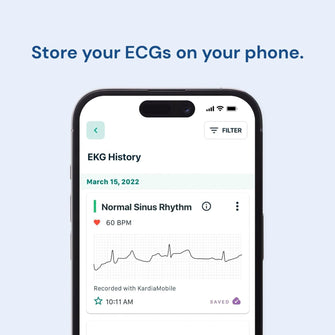 KardiaMobile 1-Lead Personal ECG Heart Monitor Convenient, Accurate He ...